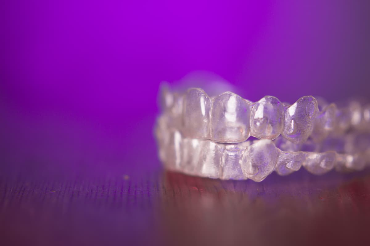 Invisalign First in Early Orthodontic Care | Straight Orthodontics ...